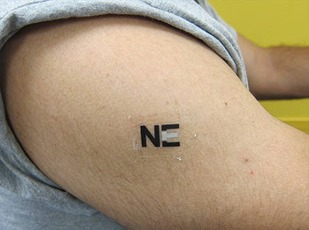 Medical Sensor Tattoos