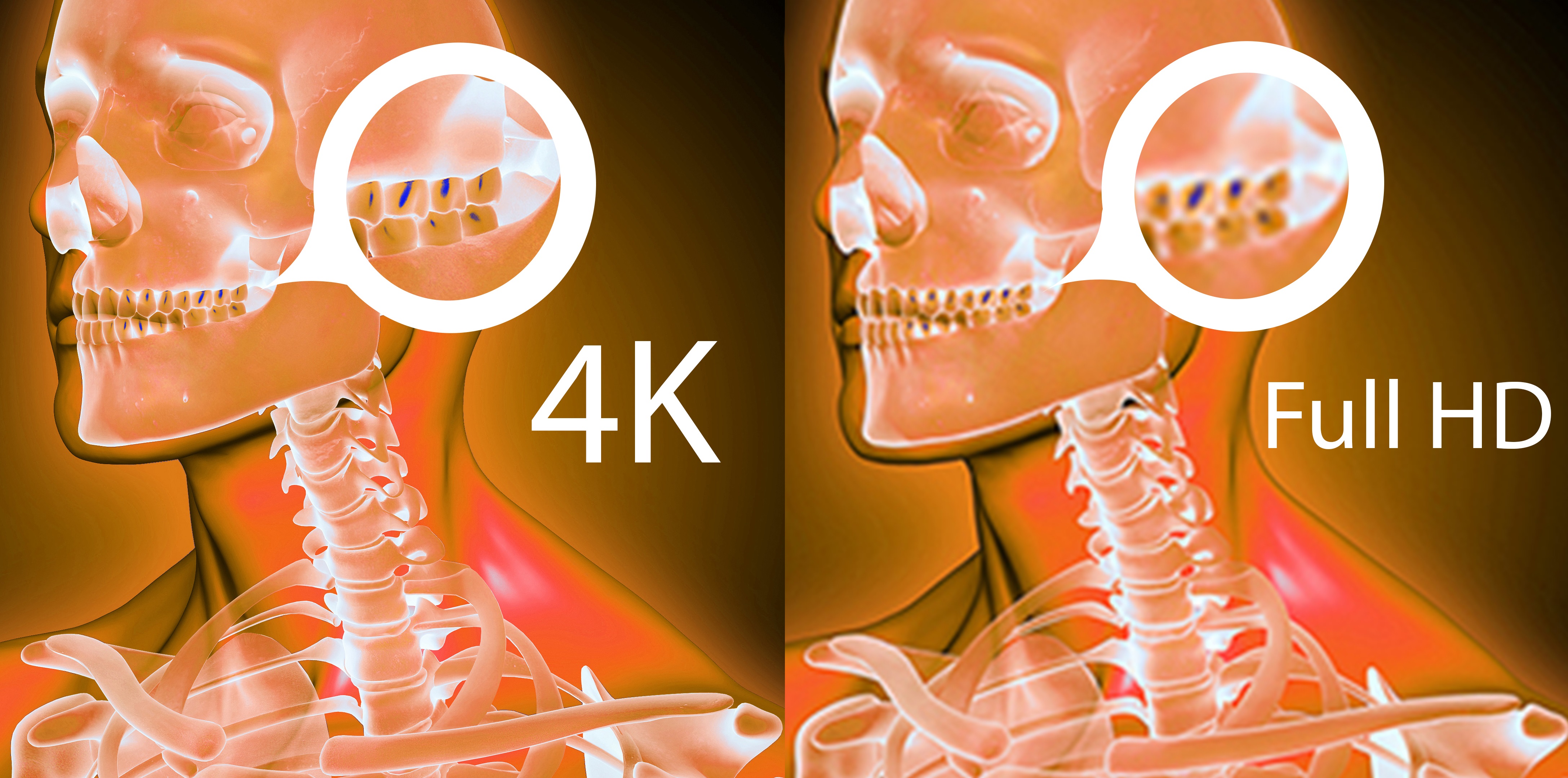 Medical devices can see benefit of 4K video | Electronics Weekly