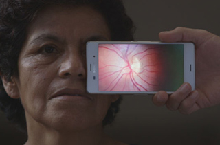 Phone apps could equal conventional eye tests for remote communities ...