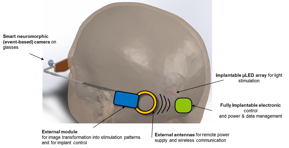 Attempt to restore sight by direct brain stimulation | Electronics Weekly