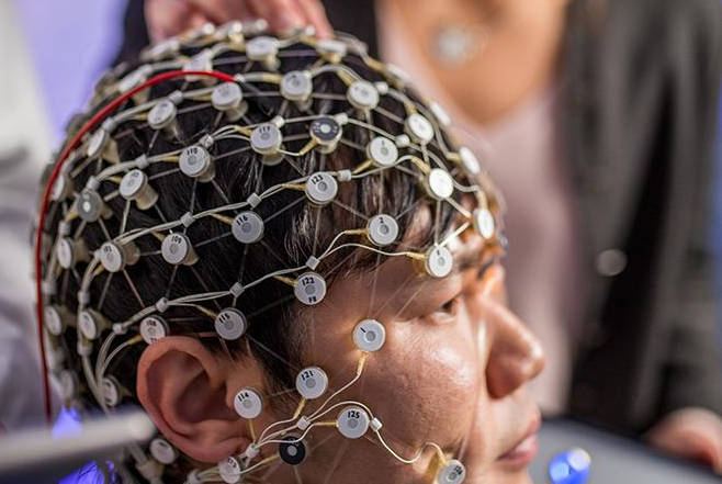 Specific electrical scalp stimulation appears to reduce depression ...