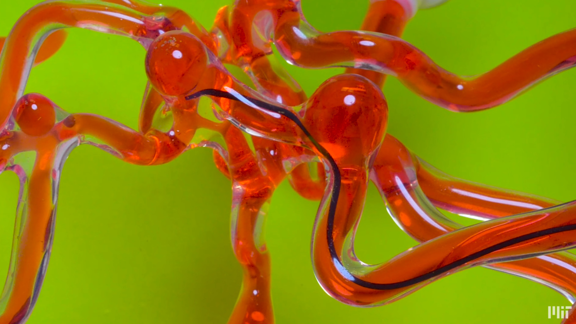 Picture of the Day: MIT's thread-like robot wends through vasculature ...
