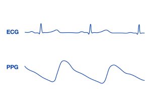 PPG vs ECG heart rate sensors | Electronics Weekly