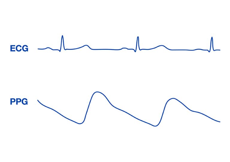 PPG vs ECG heart rate sensors | Electronics Weekly