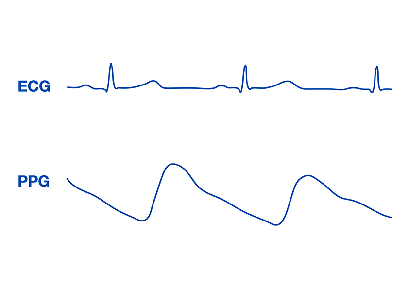 PPG vs ECG heart rate sensors | Electronics Weekly
